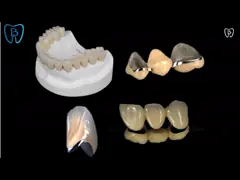 Durable Flexible PFM Bridge Crown Dental IPS E Max Press Inlay Onlay