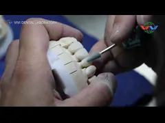 ni be free zirconia dental implant bridge on bar high esthetics