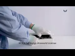 L'ultrason portatif USG d'hôpital de machine portative de l'ordinateur portable usine le scanner d'USS