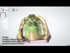 생체 호환성 치아 망원경 흰색 내부 지르코니아 외부 픽 망원경 치아