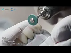 투명성 CAD EMAX 포네어 앞뒤 영역에 대한 닦은 유리 세라믹 복원