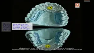 removable orthodontic appliance for easy to clean convenient removal with worry free correction