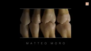 full zirconia ceramic dentures high precision digital production for functional restoration