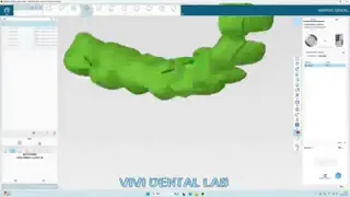 ivoclar digital dental crowns process noritake porcelain high accuracy