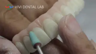 high esthetics dental implant crown / screw retained crown iso approved